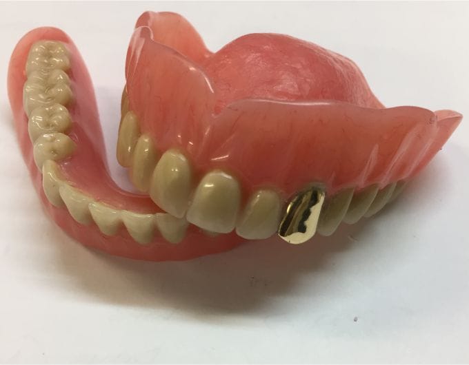 Tooth Jewels | Shine Dental